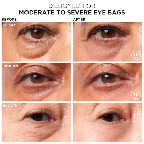 IT Cosmetics Bye Bye Under Eye Bags Treatment For Women & Men ...